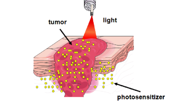 Red Laser Diodes for Photodynamic Therapy