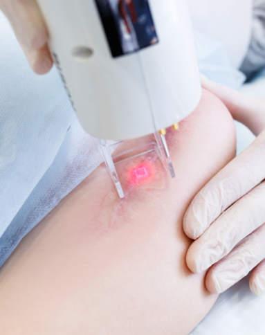 Medical Laser Solutions for OEM Integration | RPMC